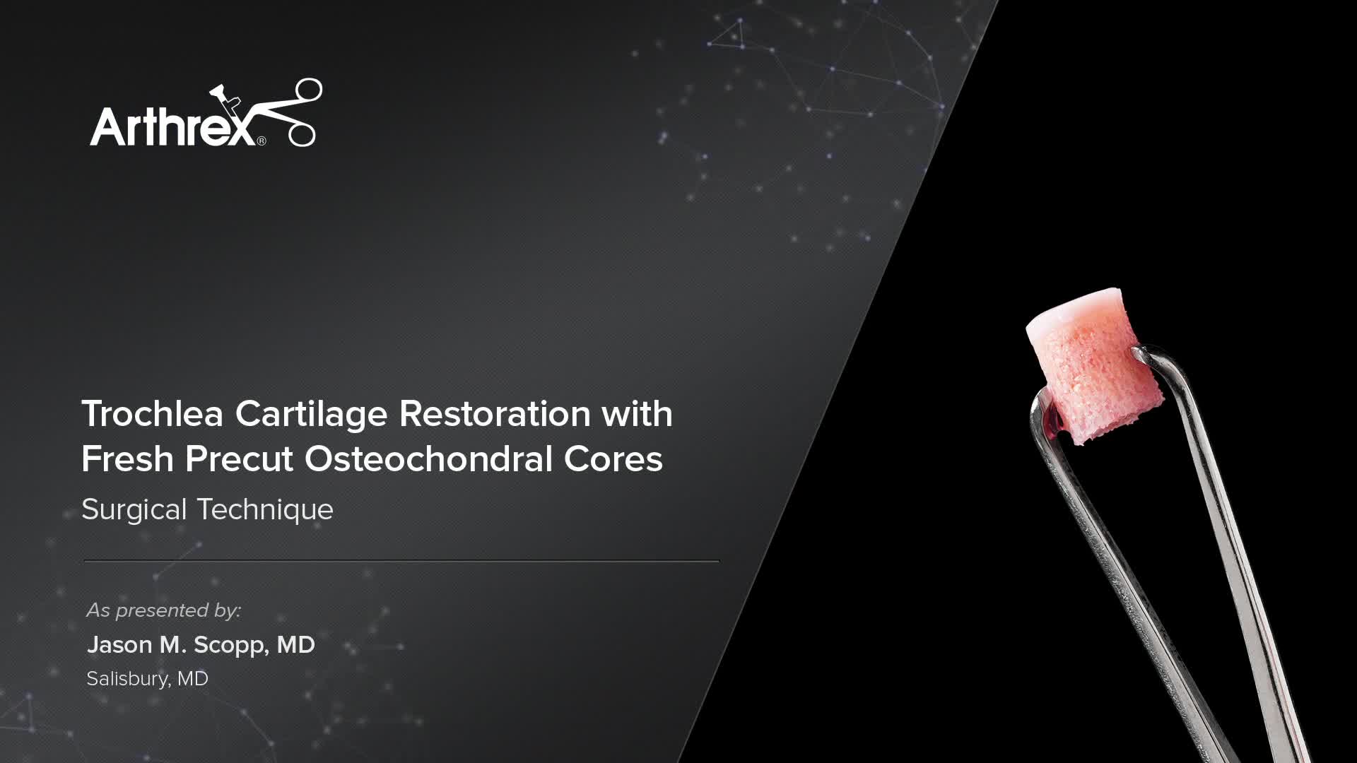 Arthrex - Trochlea Cartilage Restoration with Fresh Precut ...