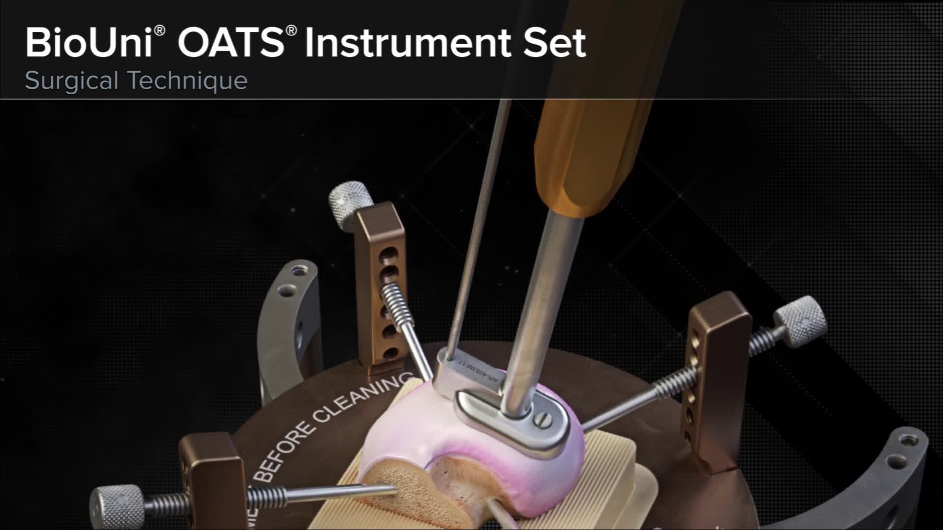 Arthrex - BioUni® OATS Instrument Set