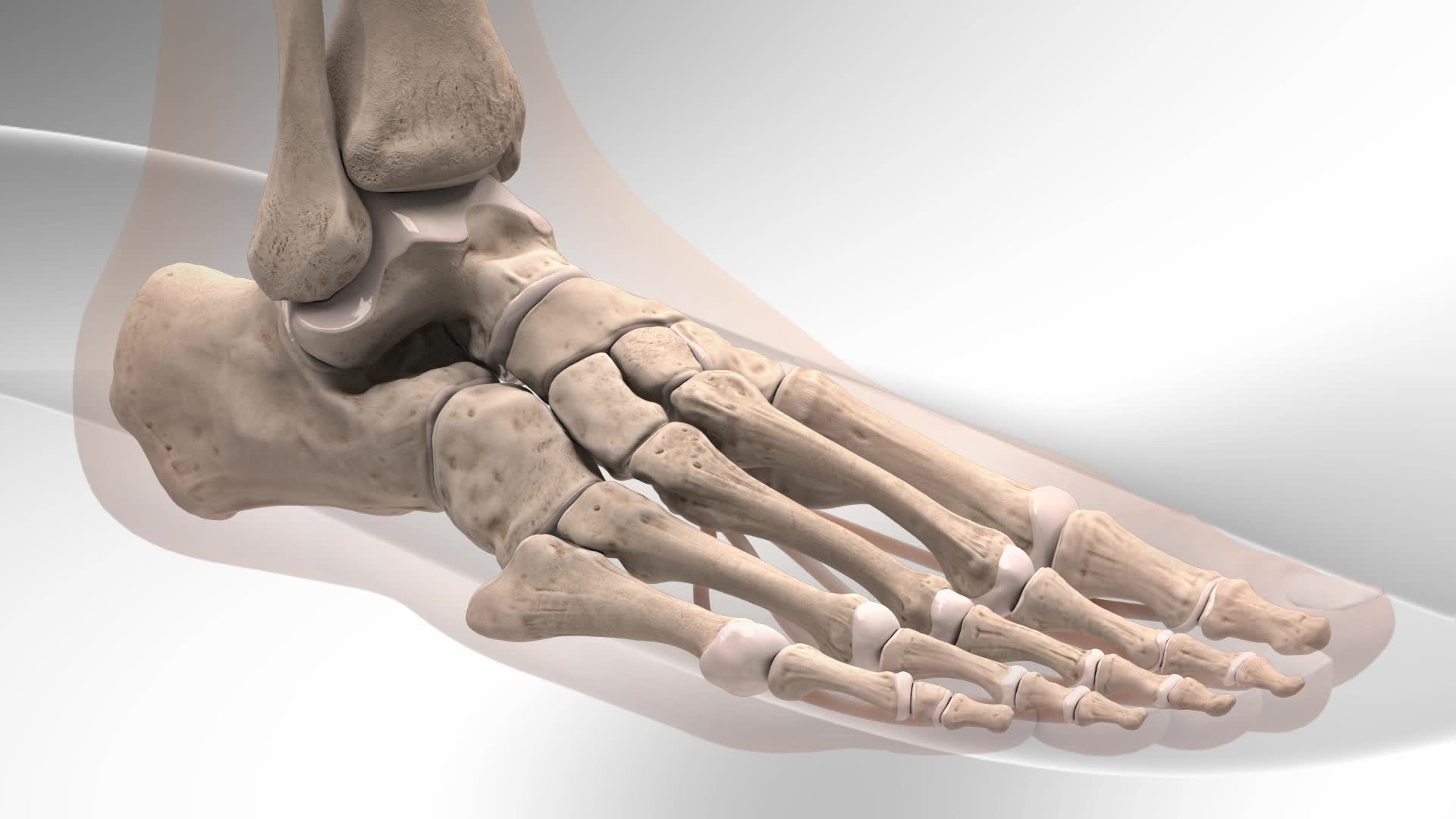 Arthrex - Flatfoot Repair With the InternalBrace™ Ligament Augmentation ...