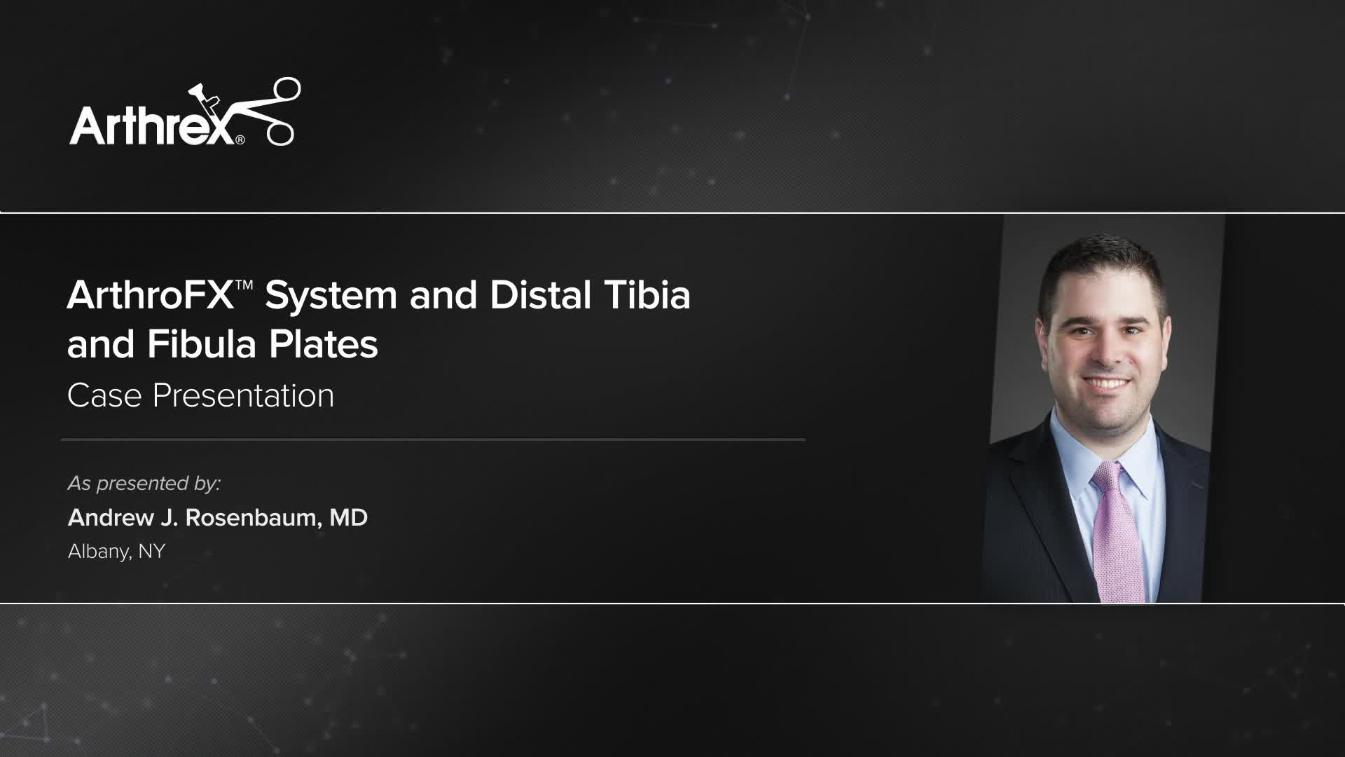 Arthrex - ArthroFX™ System and Distal Tibia and Fibula Plates