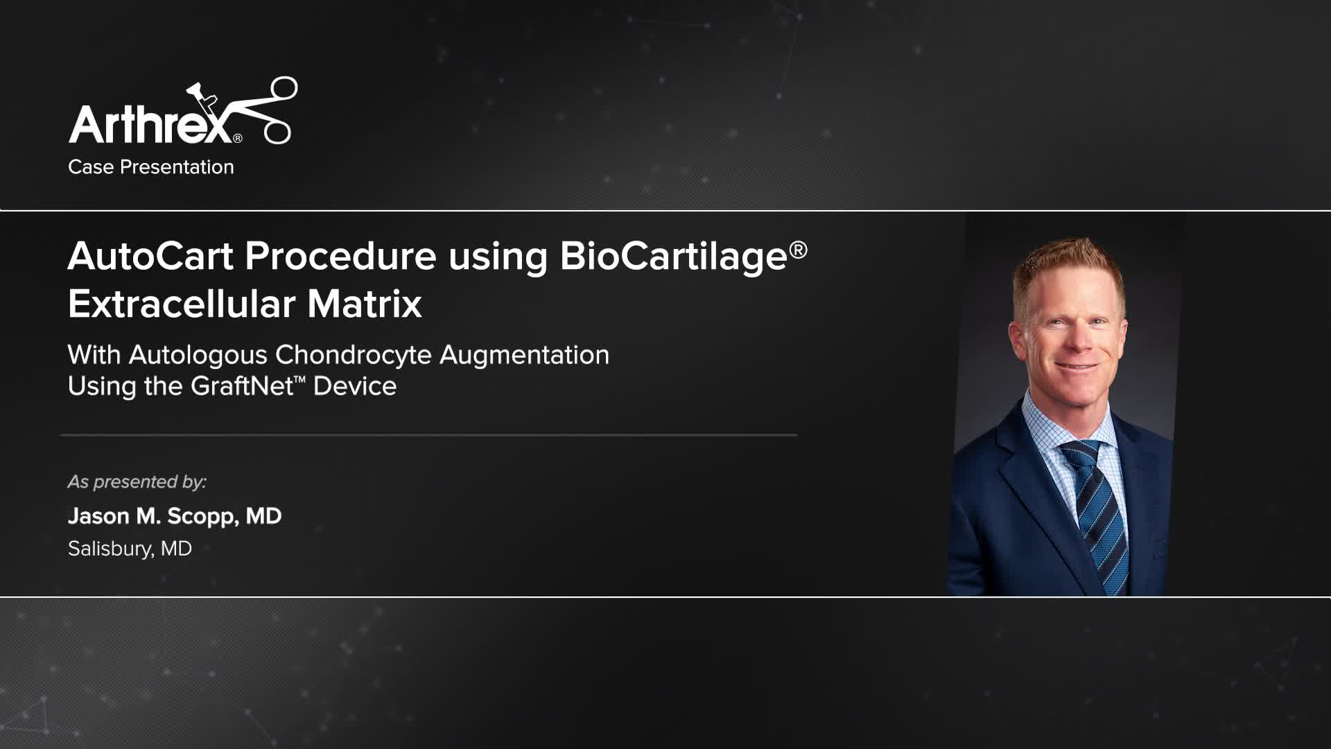 Arthrex - AutoCart™ Procedure for Symptomatic Cartilage Lesions