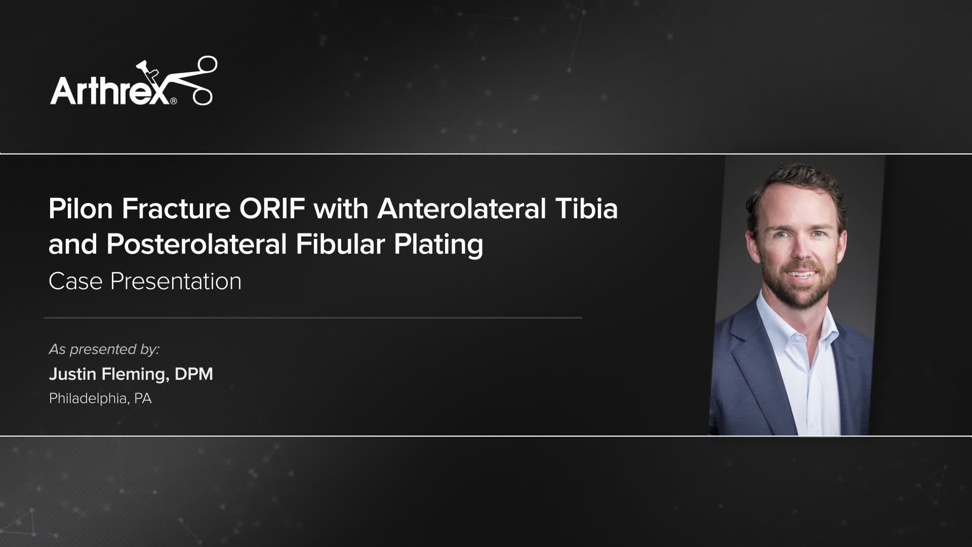 Arthrex - Pilon Fracture ORIF with Anterolateral Tibia and ...