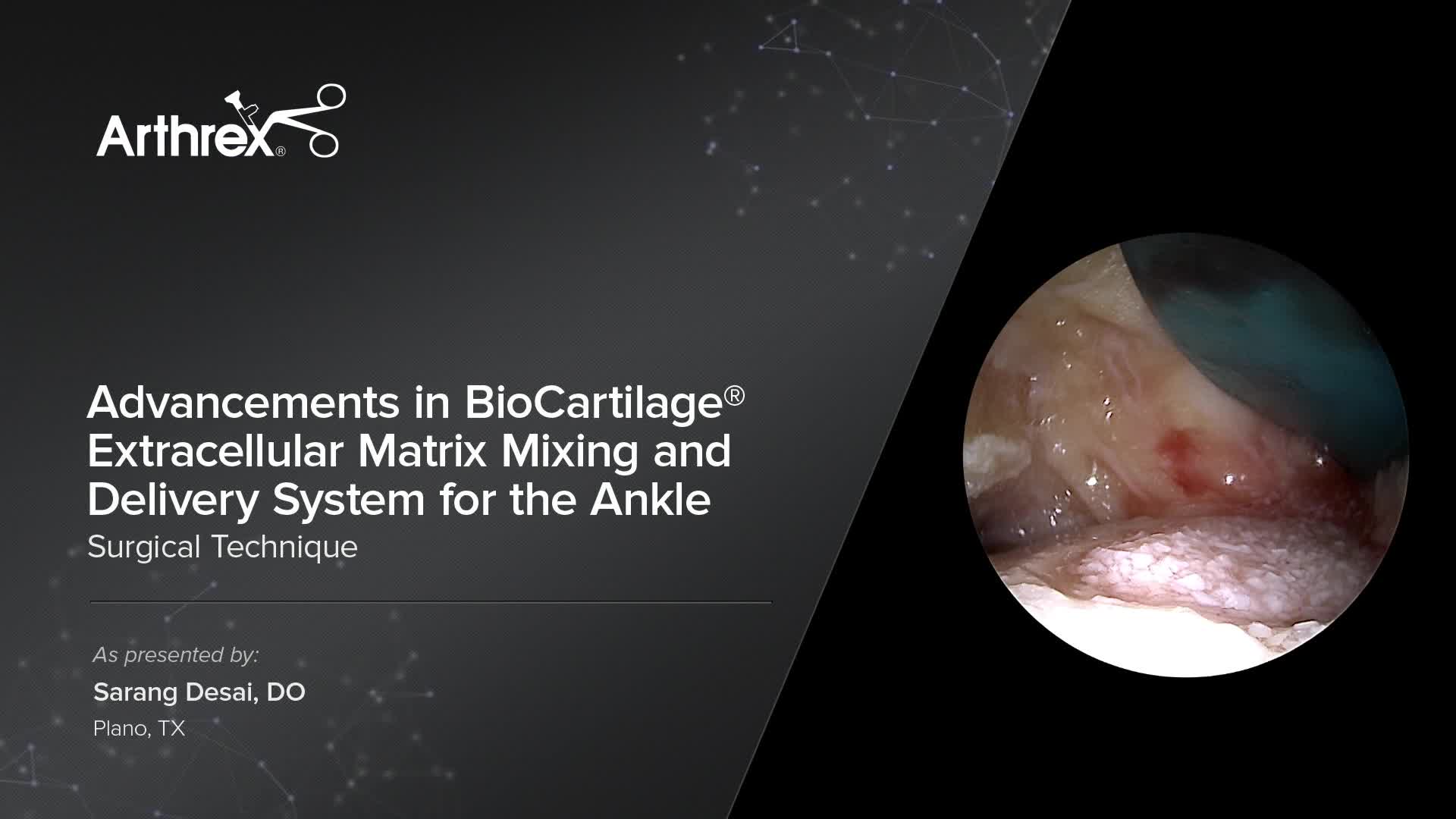 Arthrex - Advancements in BioCartilage® Extracellular Matrix Mixing and ...