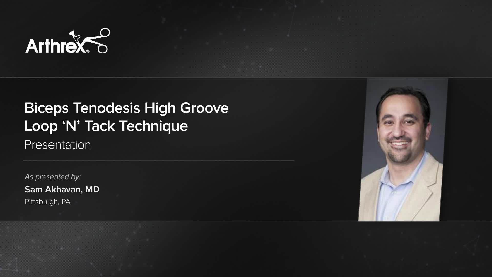 Arthrex - Biceps Tenodesis High Groove Loop 'N' Tack Technique