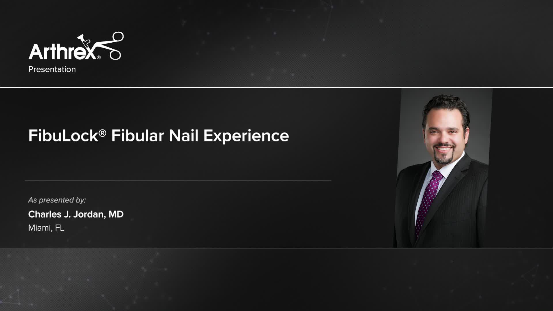 Arthrex - FibuLock® Fibular Nail Experience