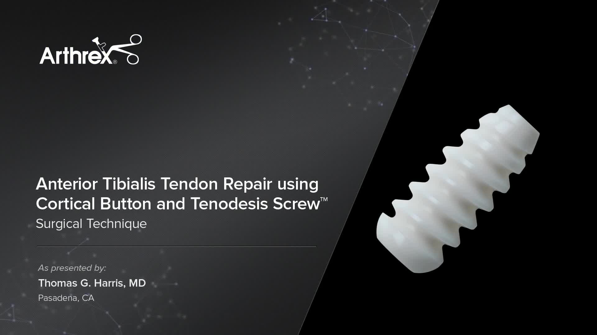 Arthrex - Anterior Tibialis Tendon Repair using Cortical Button and ...