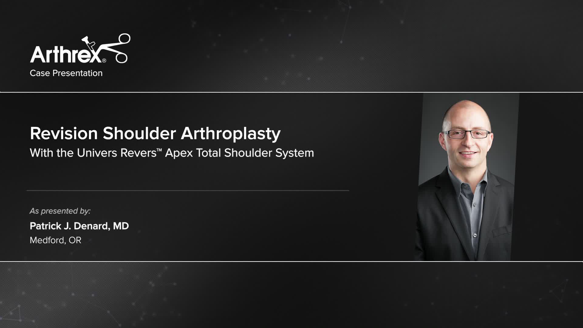 Arthrex - Revision Shoulder Arthroplasty With the Univers Revers™ Apex ...