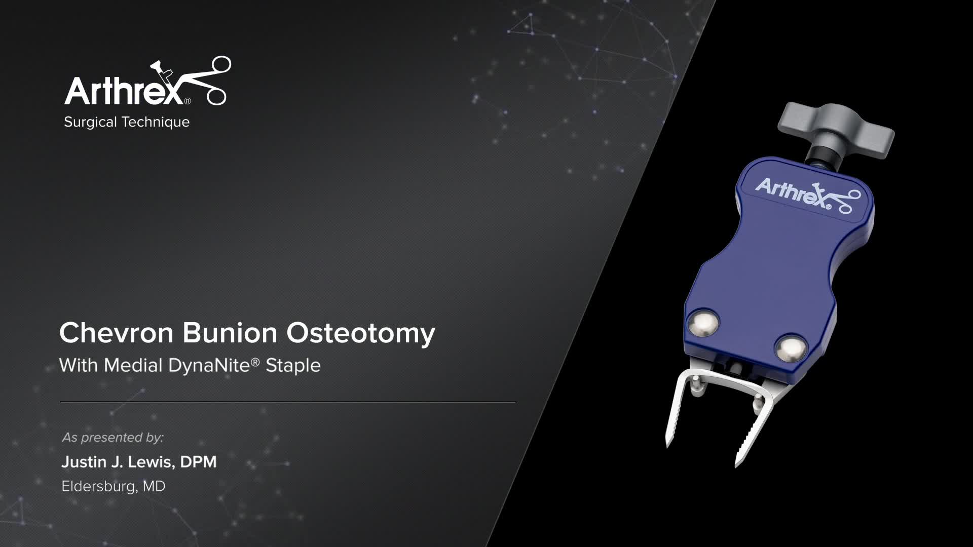 Arthrex - Chevron Bunion Osteotomy With Medial DynaNite® Staple