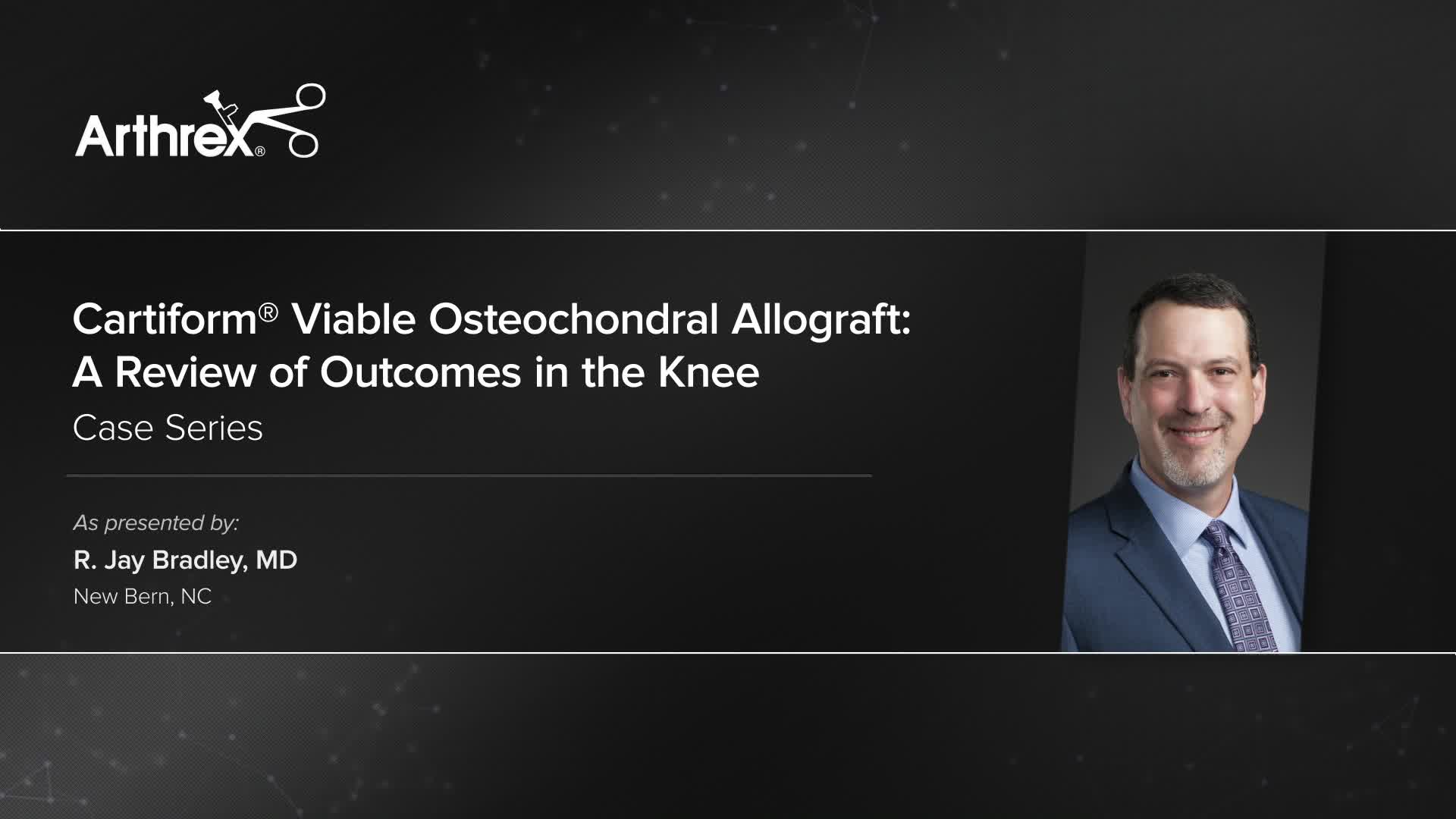 Arthrex - Cartiform® Viable Osteochondral Allograft: A Review of ...