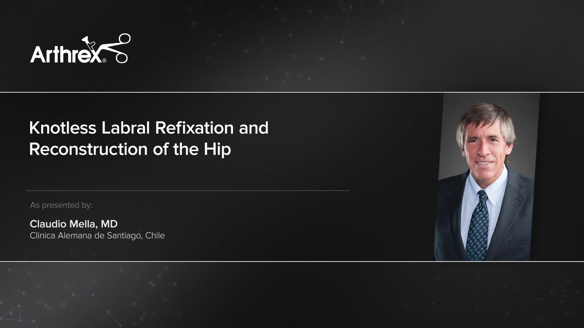 Arthrex - Knotless Labral Refixation and Reconstruction of the Hip