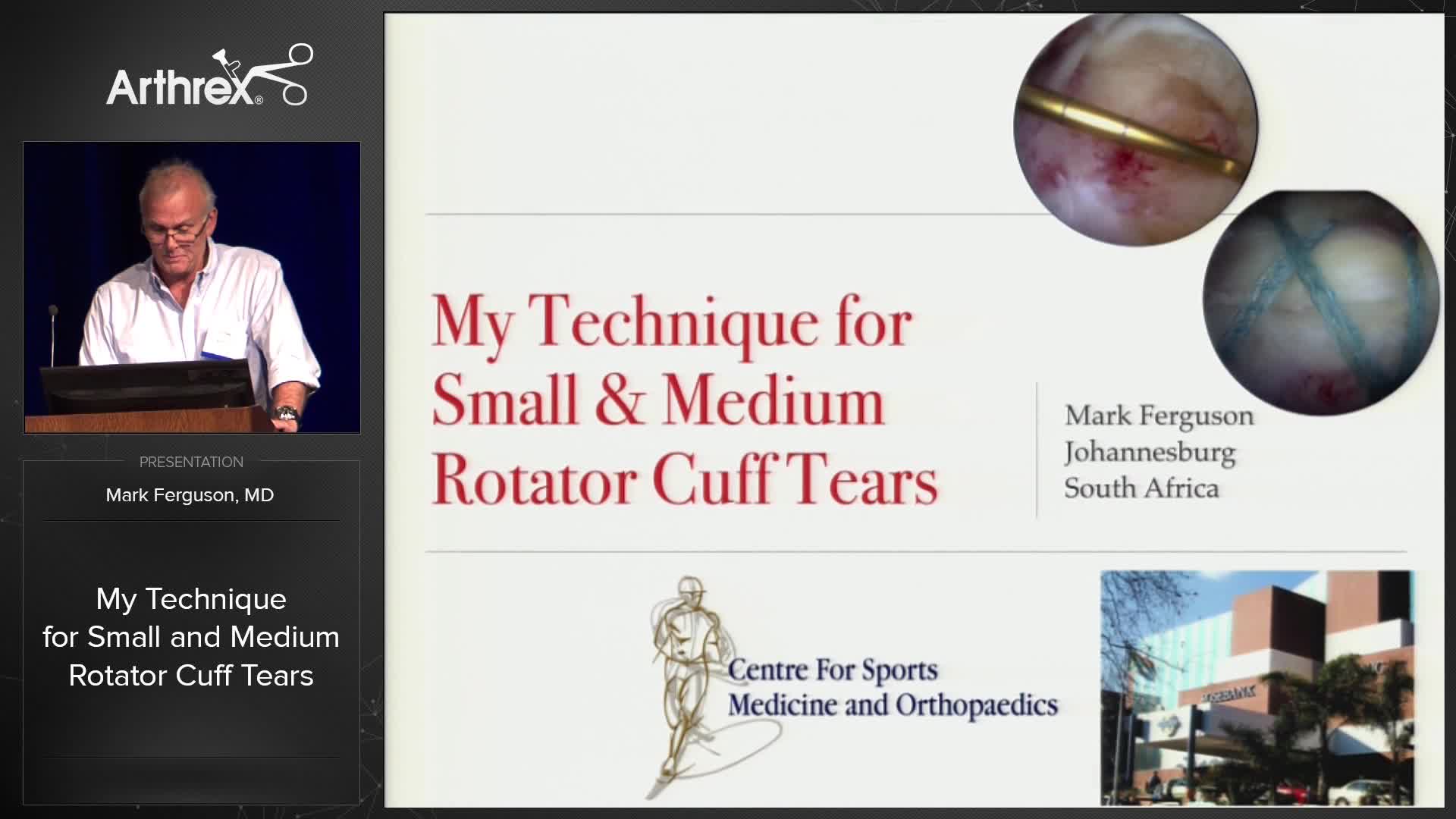 Arthrex My Technique For Small And Medium Rotator Cuff Tears