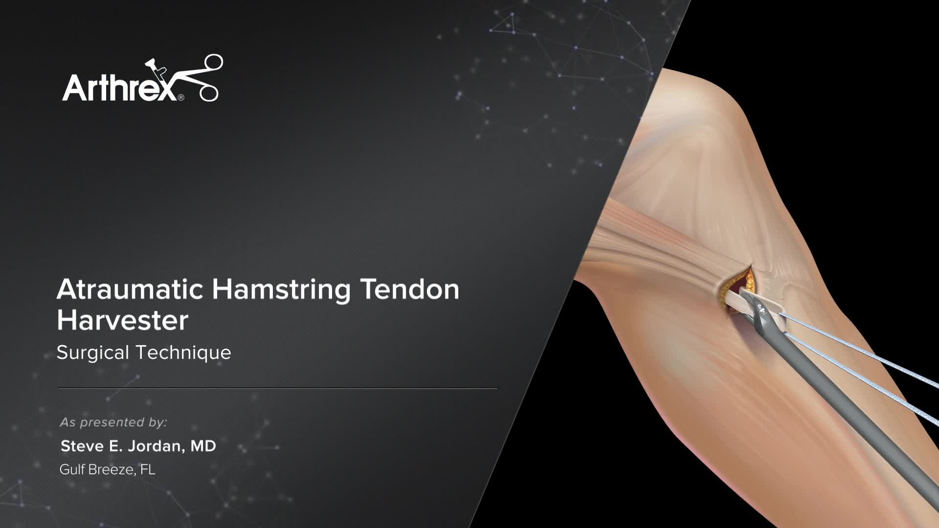 Arthrex - Atraumatic Hamstring Tendon Harvester