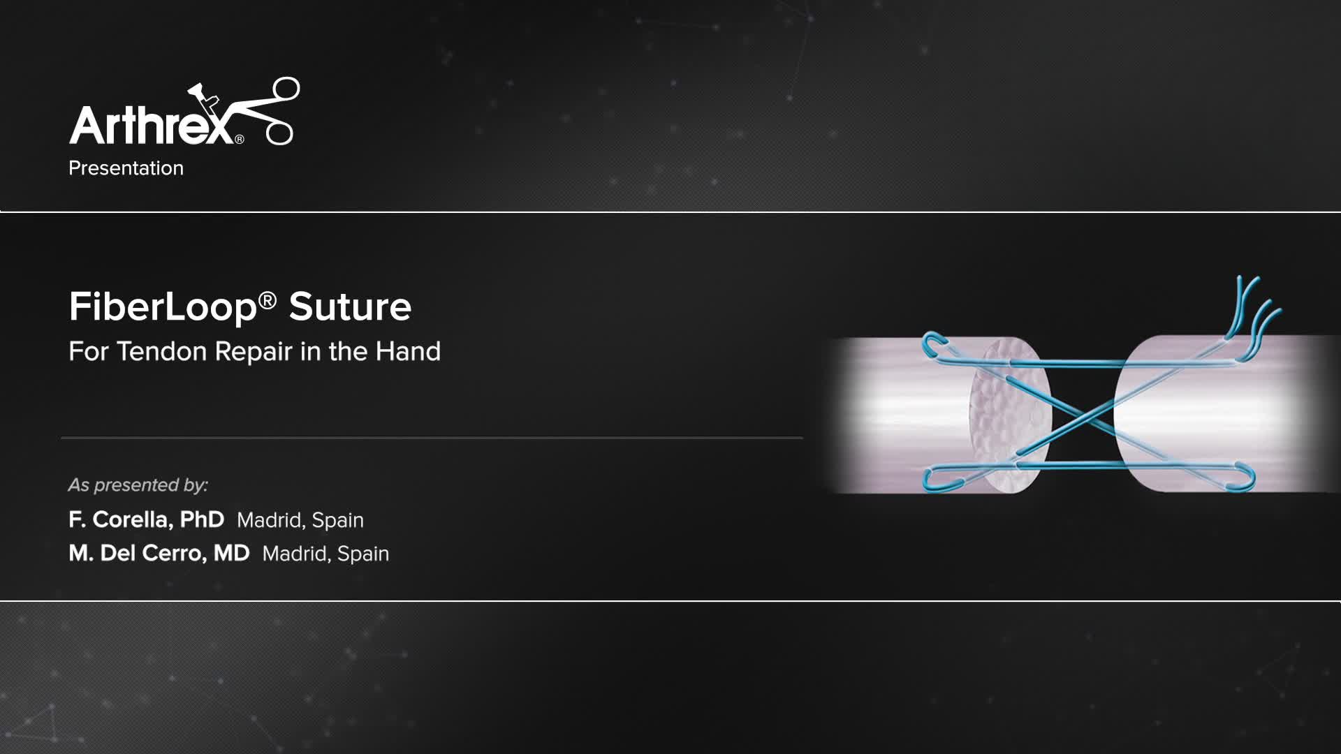 Arthrex - FiberLoop® Suture for Tendon Repair in the Hand