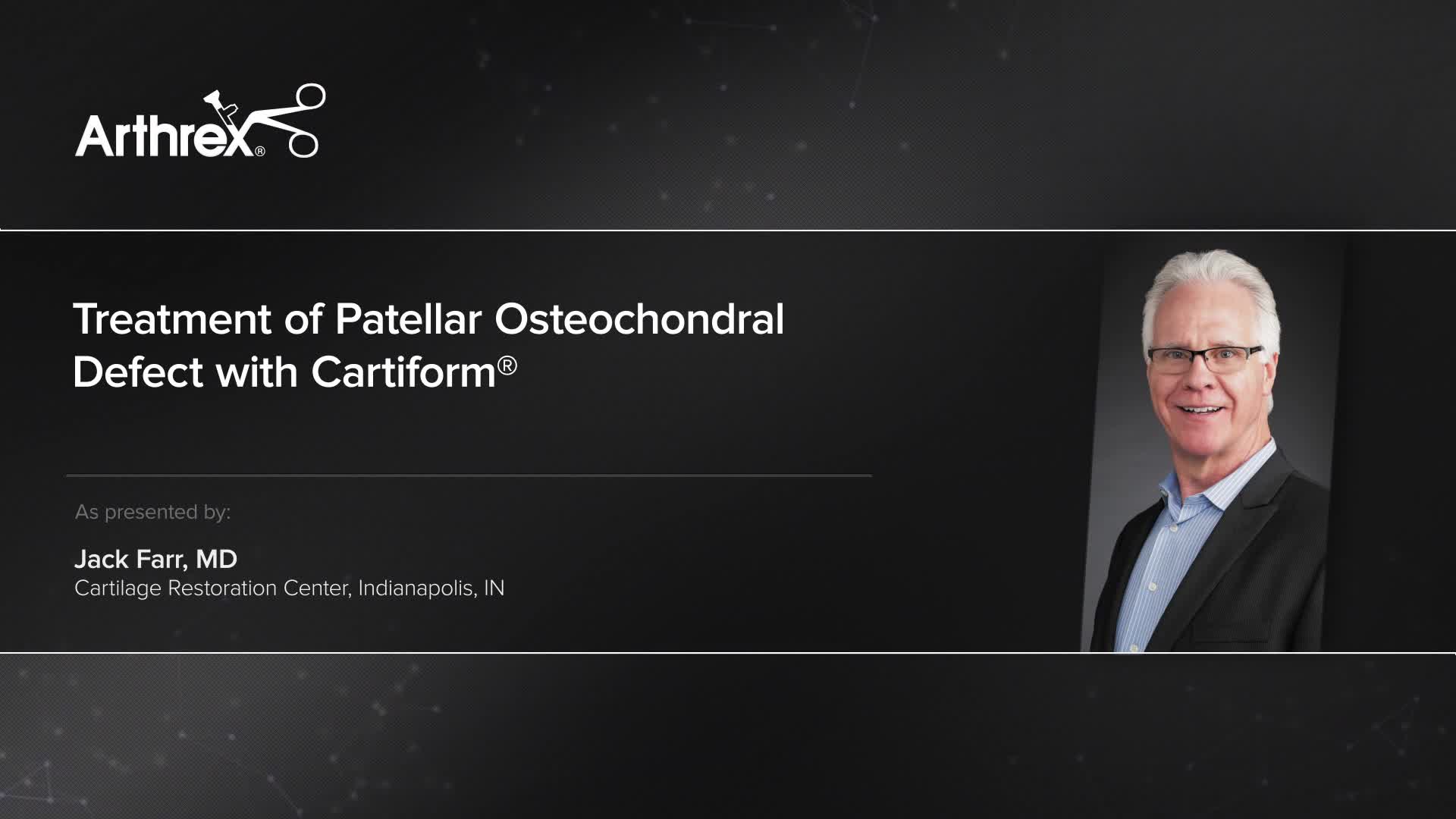 Arthrex - Treatment of Patellar Osteochondral Defect with Cartiform®