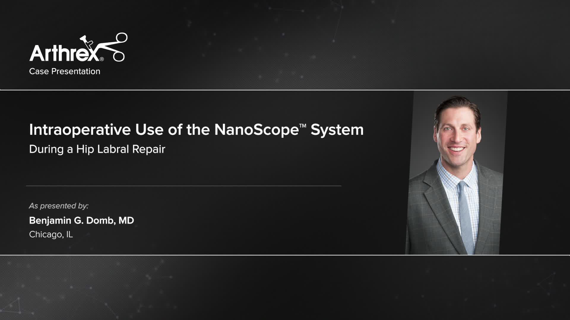 Arthrex - Intraoperative Use of the NanoScope™ System During a Hip ...