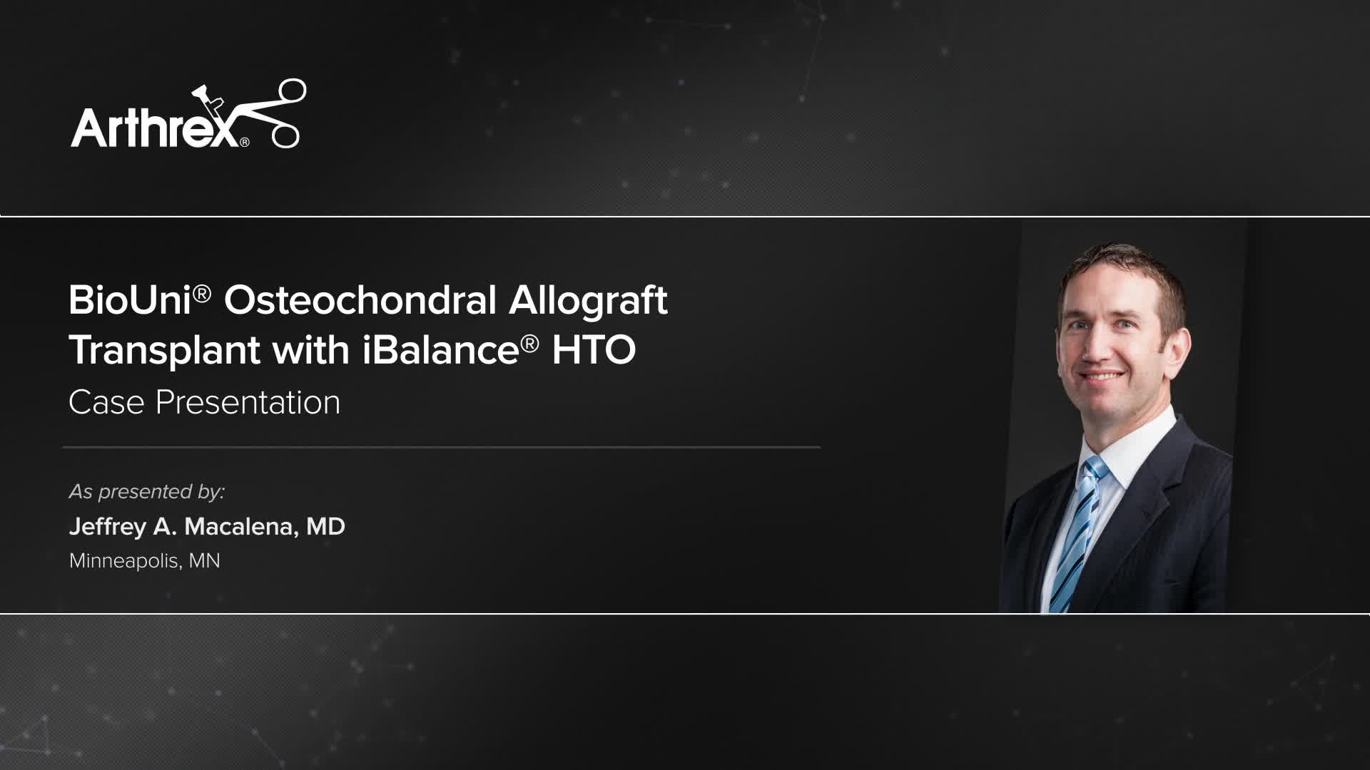 Arthrex - BioUni® Osteochondral Allograft Transplant with iBalance® HTO