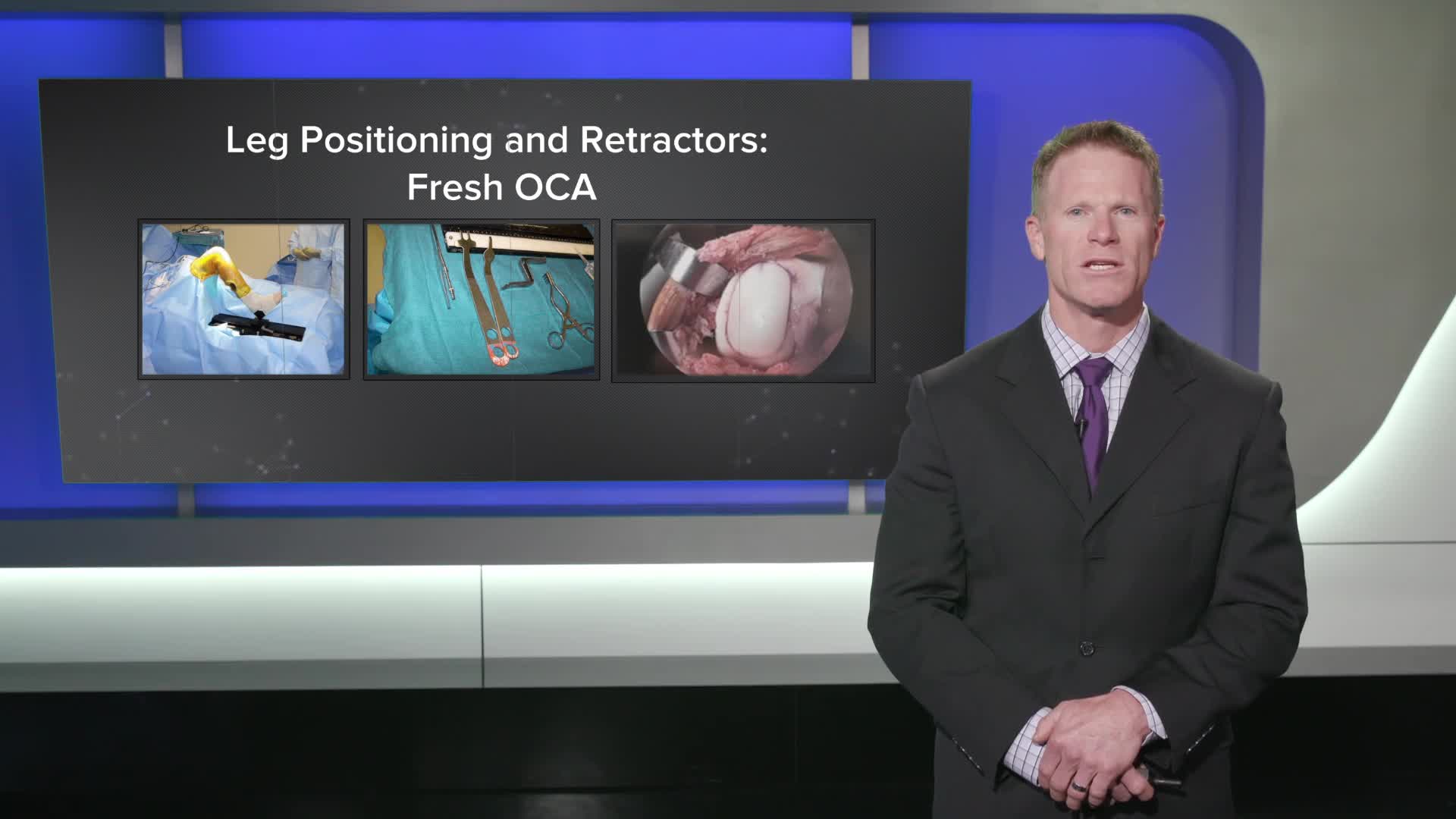 Arthrex - iBalance® HTO System with BioUni® Osteochondral Allograft ...