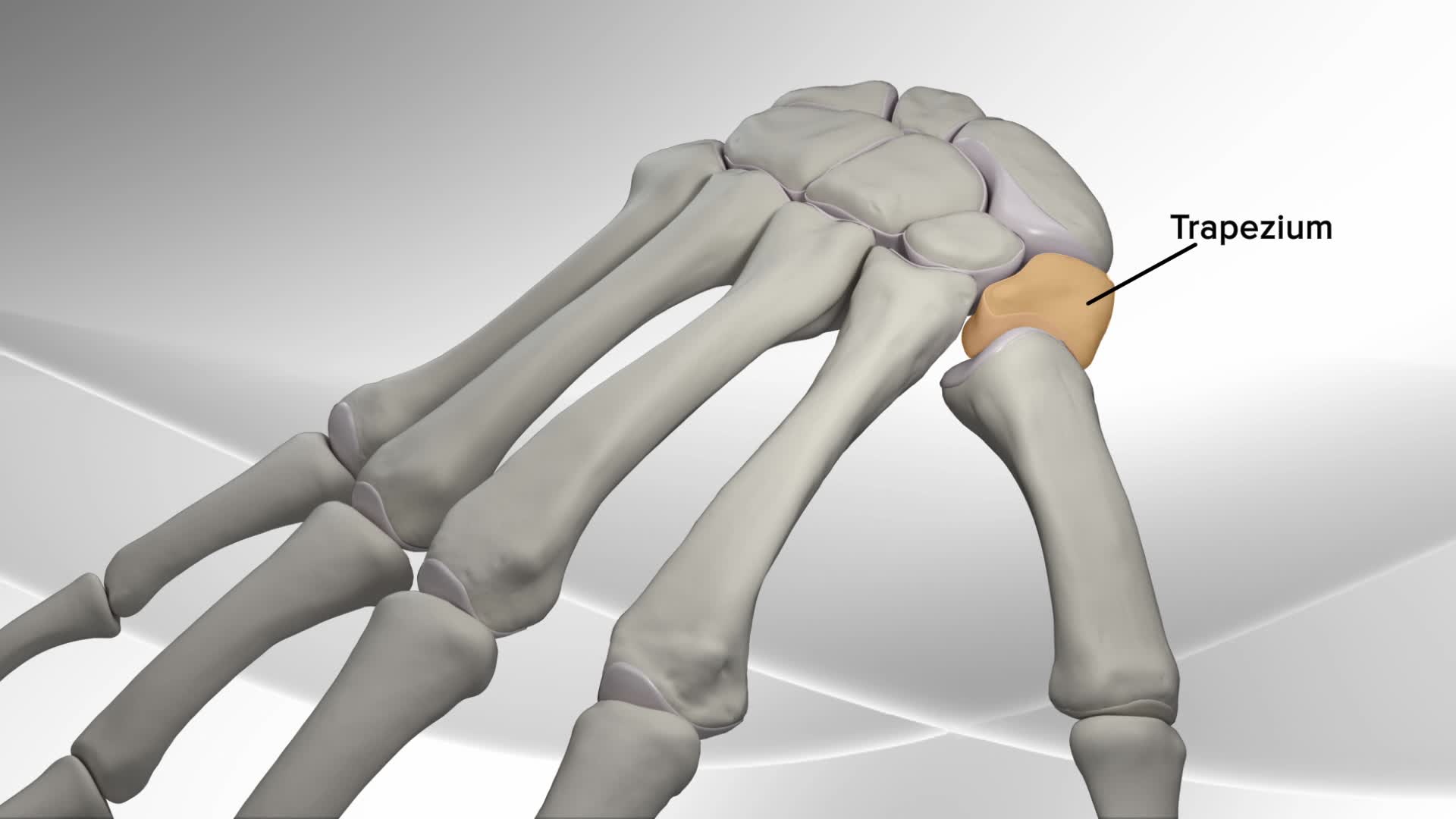 Arthrex - Thumb Metacarpal Arthritis Repair with CMC Mini TightRope® System