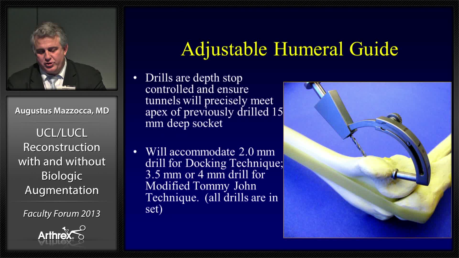 Arthrex - UCL/LUCL Reconstruction with and without Biologic Augmentation