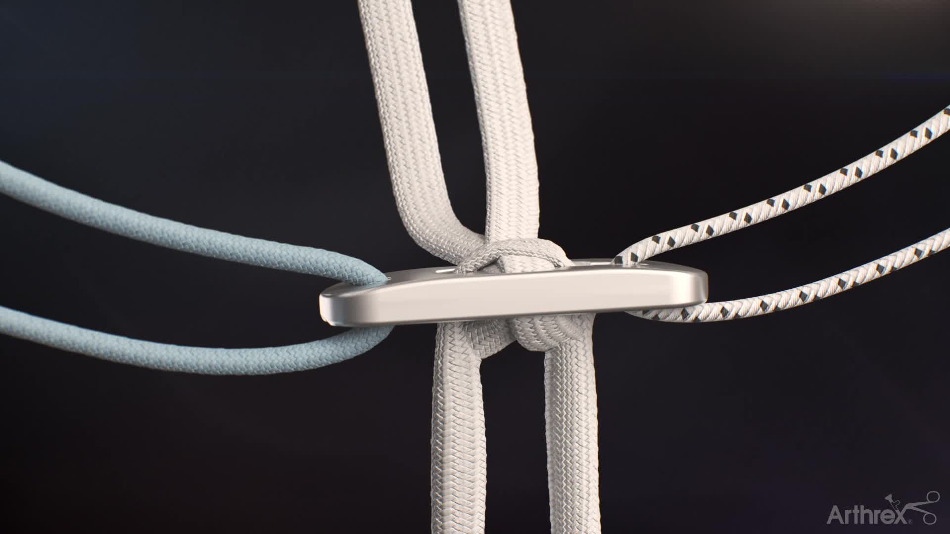 Arthrex - QuadLink™ All-Epiphyseal, All-Inside ACL Reconstruction Using the FiberTag® TightRope ...