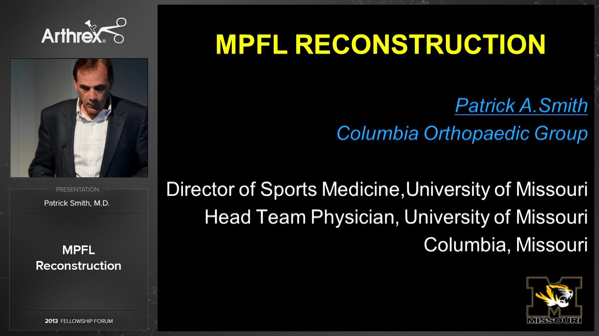 Arthrex - MPFL Reconstruction