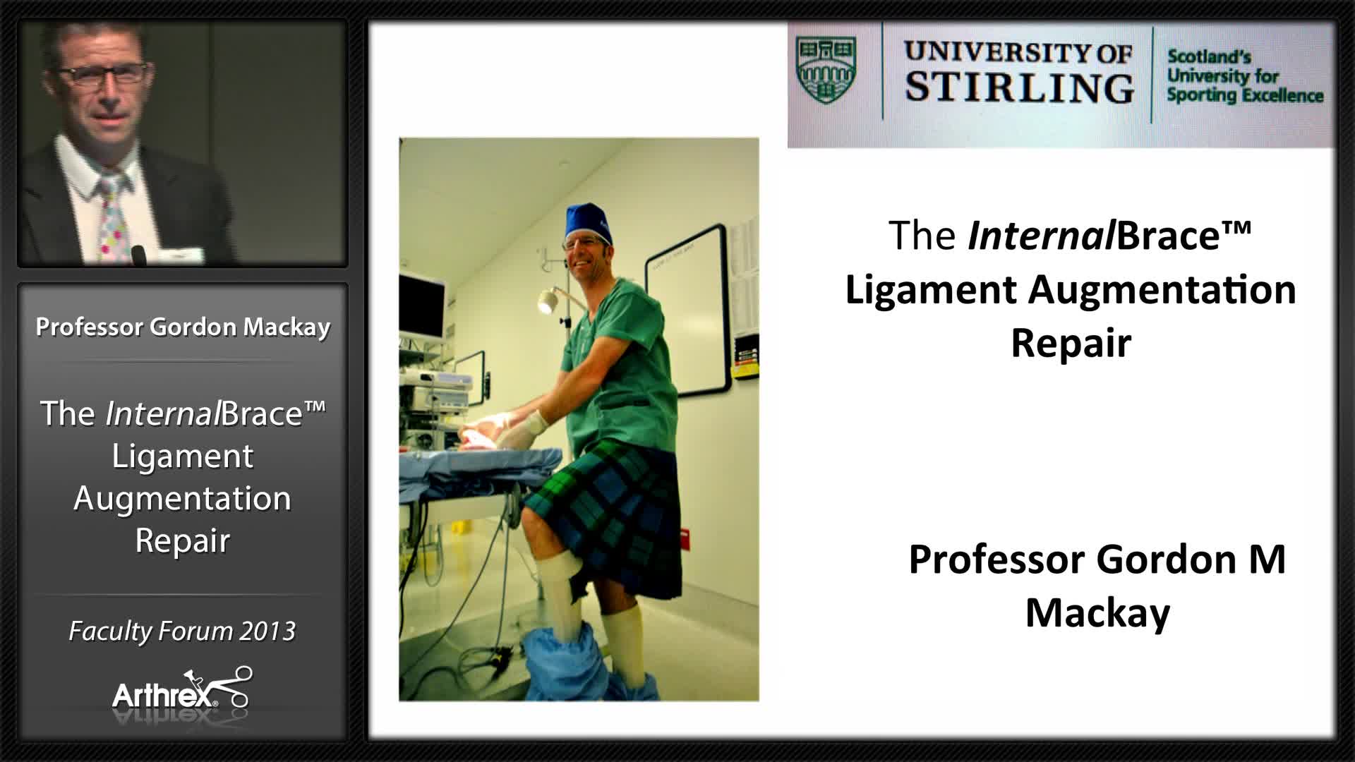 Arthrex - The InternalBrace™ Ligament Augmentation Repair