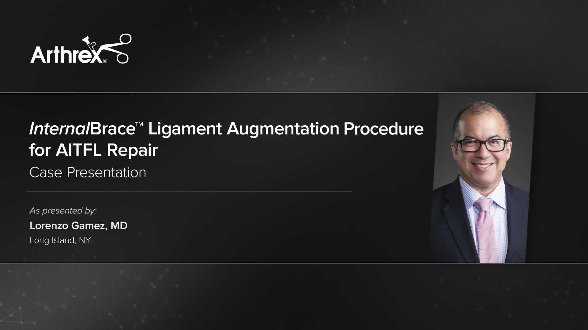 Arthrex - InternalBrace™ Ligament Augmentation Procedure for AITFL Repair