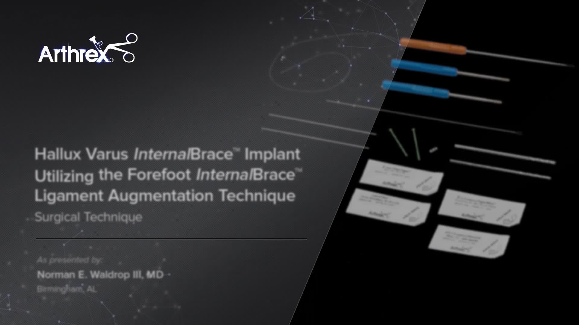 Arthrex - Hallux Varus InternalBrace™ Repair Using the Forefoot ...
