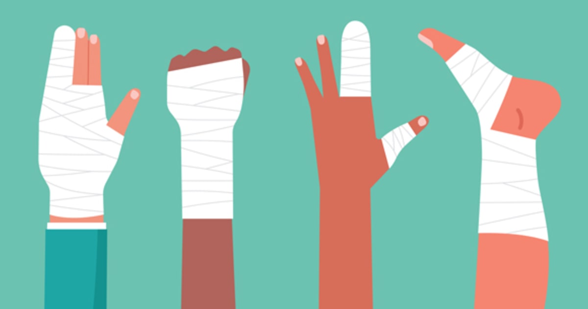 What is an avulsion fracture? | Baptist Heath | Jacksonville, Fl