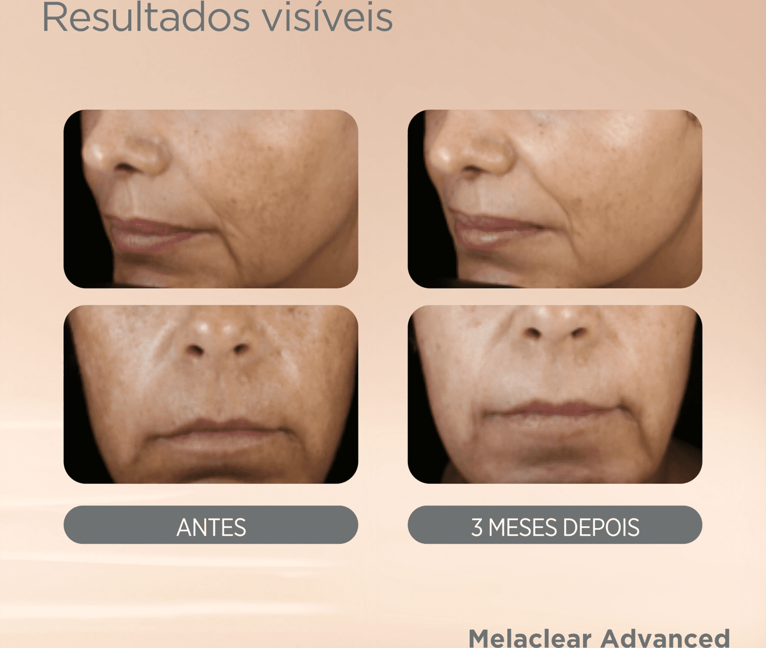 Kit ISDIN Melaclear Advanced Fusion Water | Beleza na Web