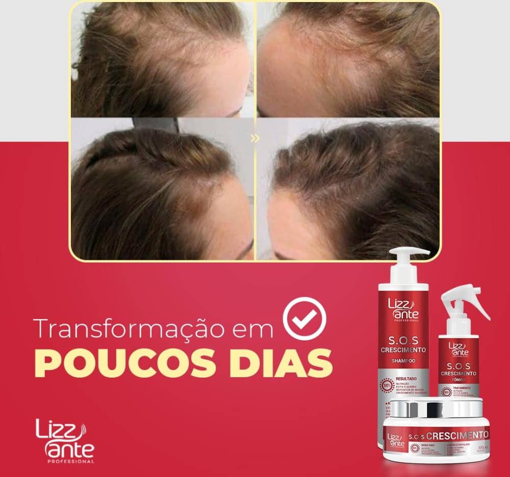Kit Lizz ante Professional S.O.S Crescimento | Beleza Na Web