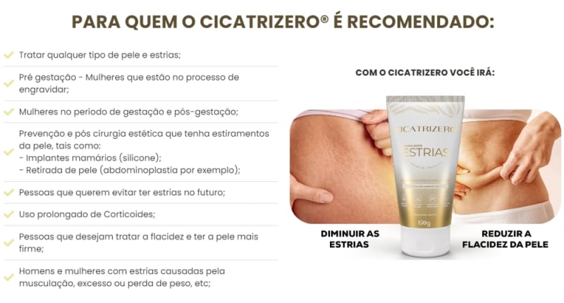 4 Cicatrizero Tratamento para todos os tipos de Estrias