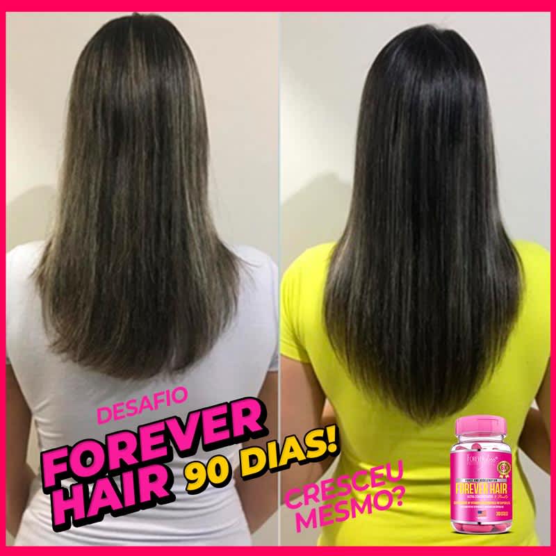 Kit Forever Liss Professional Forever Hair 3 Meses | Beleza na Web