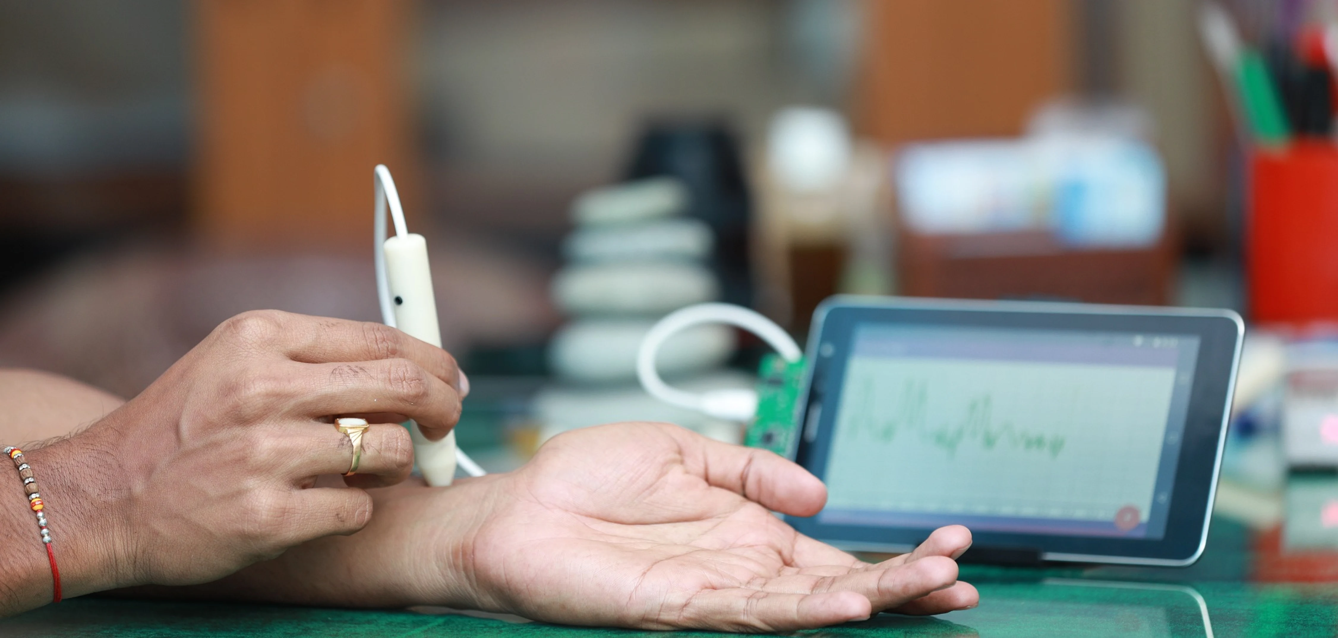 Nadishastra-Based Pulse Diagnostic System | BiggWorks