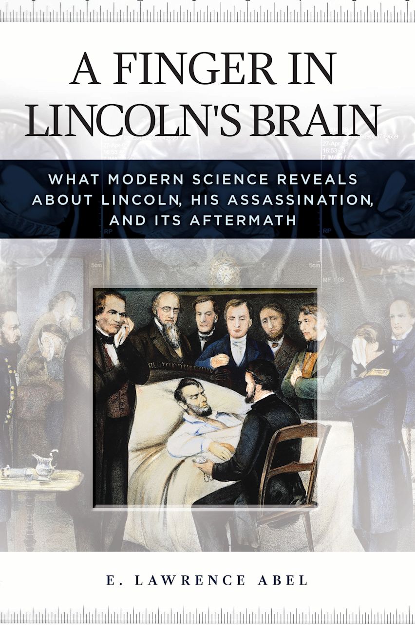 A Finger in Lincoln's Brain: What Modern Science Reveals about Lincoln ...
