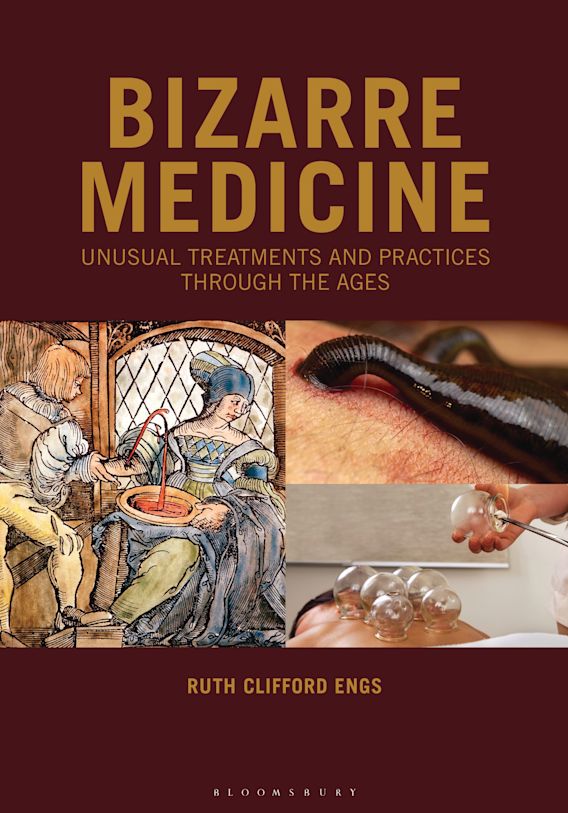 Bizarre Medicine: Unusual Treatments and Practices through the Ages ...