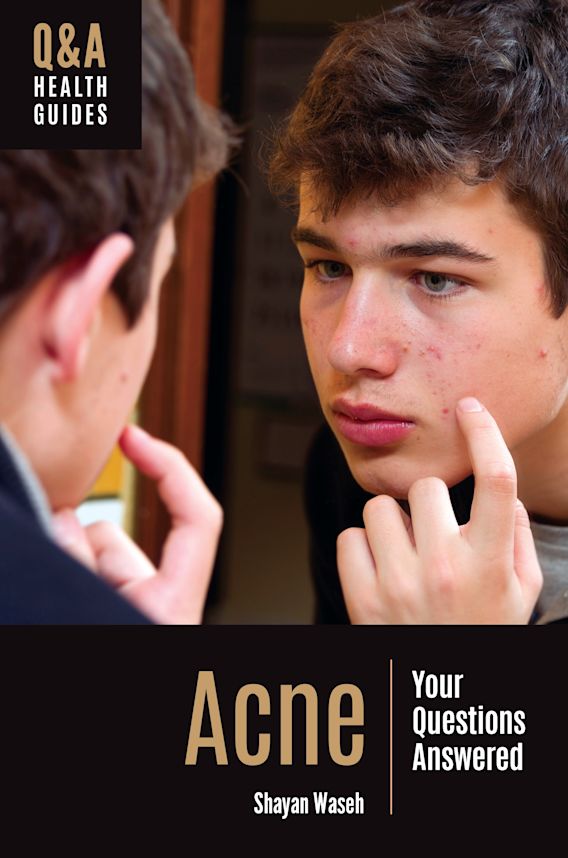 Acne: Your Questions Answered: Q&A Health Guides Shayan Waseh Greenwood