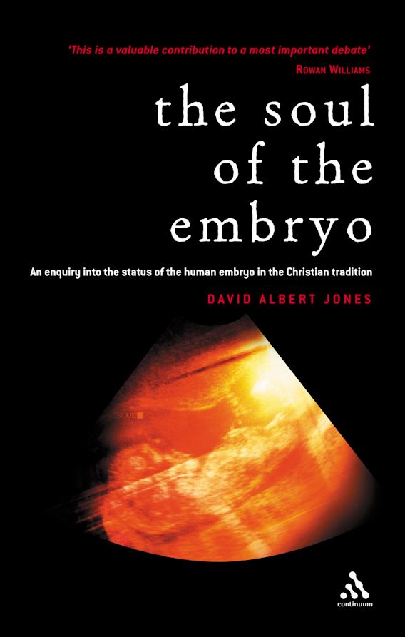 Soul of the Embryo: Christianity and the Human Embryo: David Albert ...