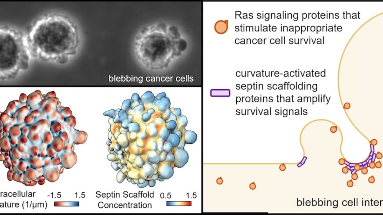 UT Southwestern Study: Cell Membrane ‘blebs’ Could Hold New Targets for ...