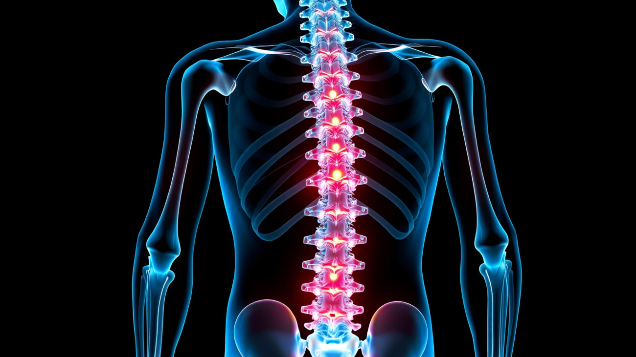 Pediatric Spine Center Referral Guide - UCSF Pediatrics