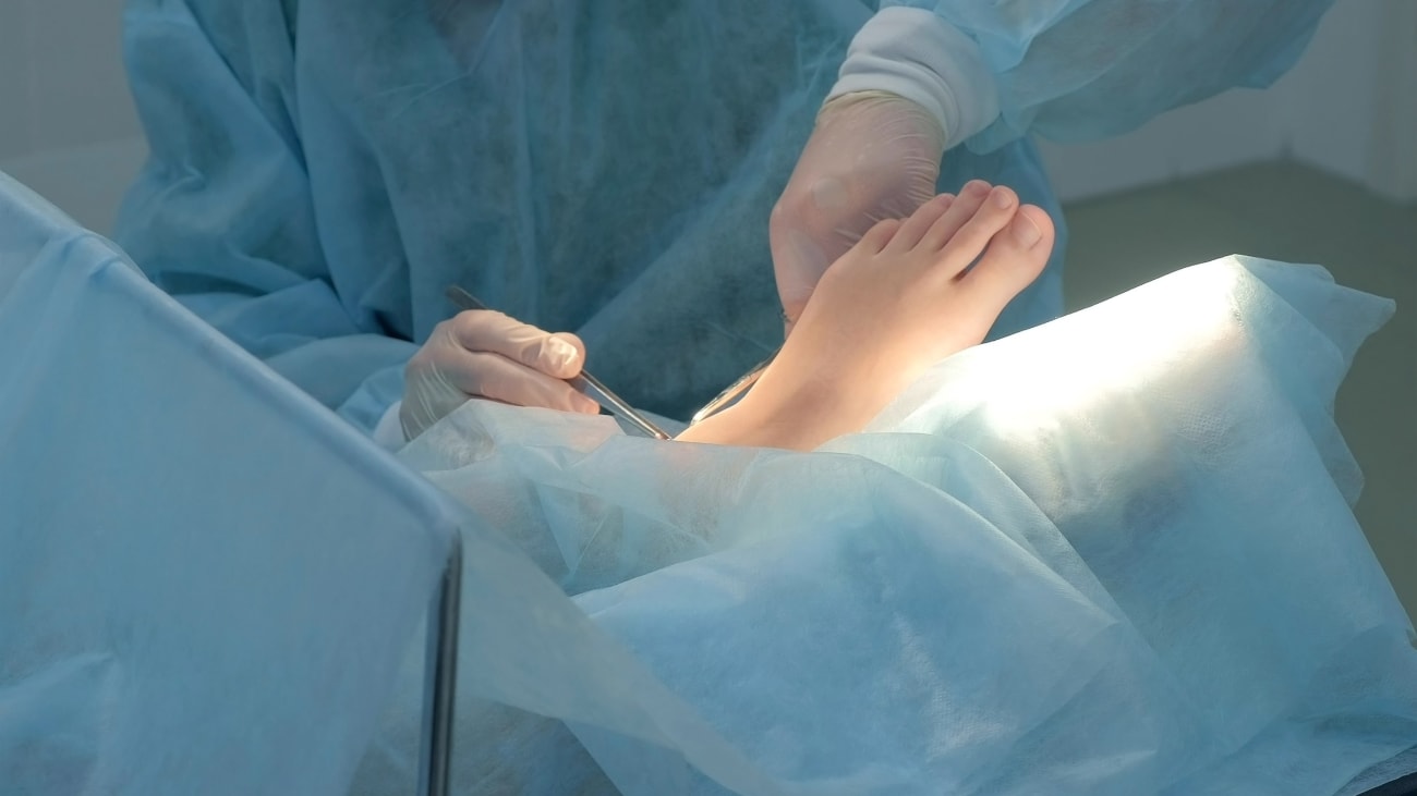 Outcomes of open reduction and internal fixation of calcaneus fractures ...