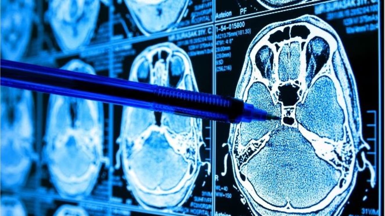 Roswell Park Presents ‘Highly Encouraging’ Phase 2A Results on SurVaxM Immunotherapy for ...