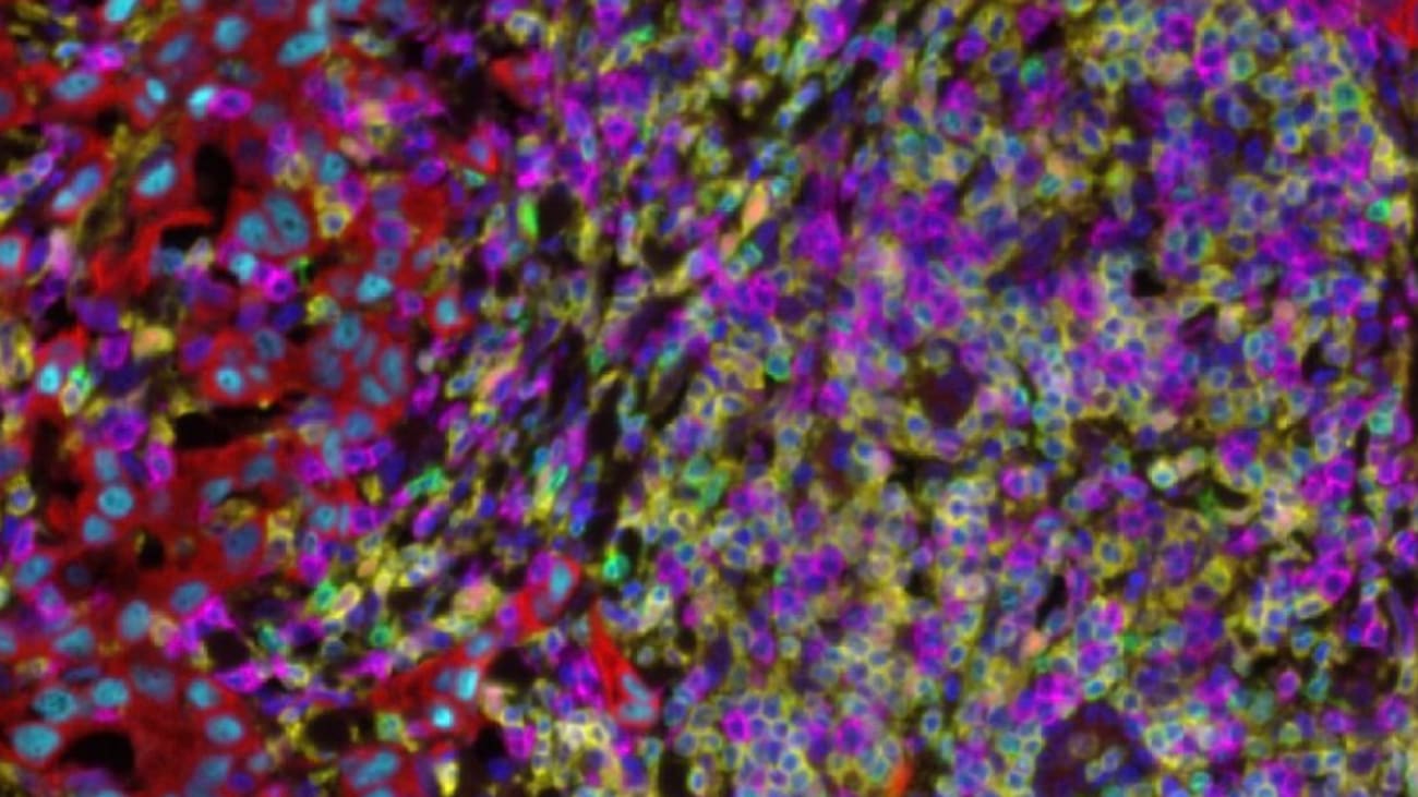 A Cancer Innovation Engine: 10 Roswell Park Research Advances to Look ...