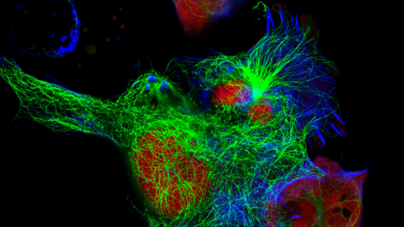 UT Southwestern researchers seek to light up cancer cells so surgeons ...