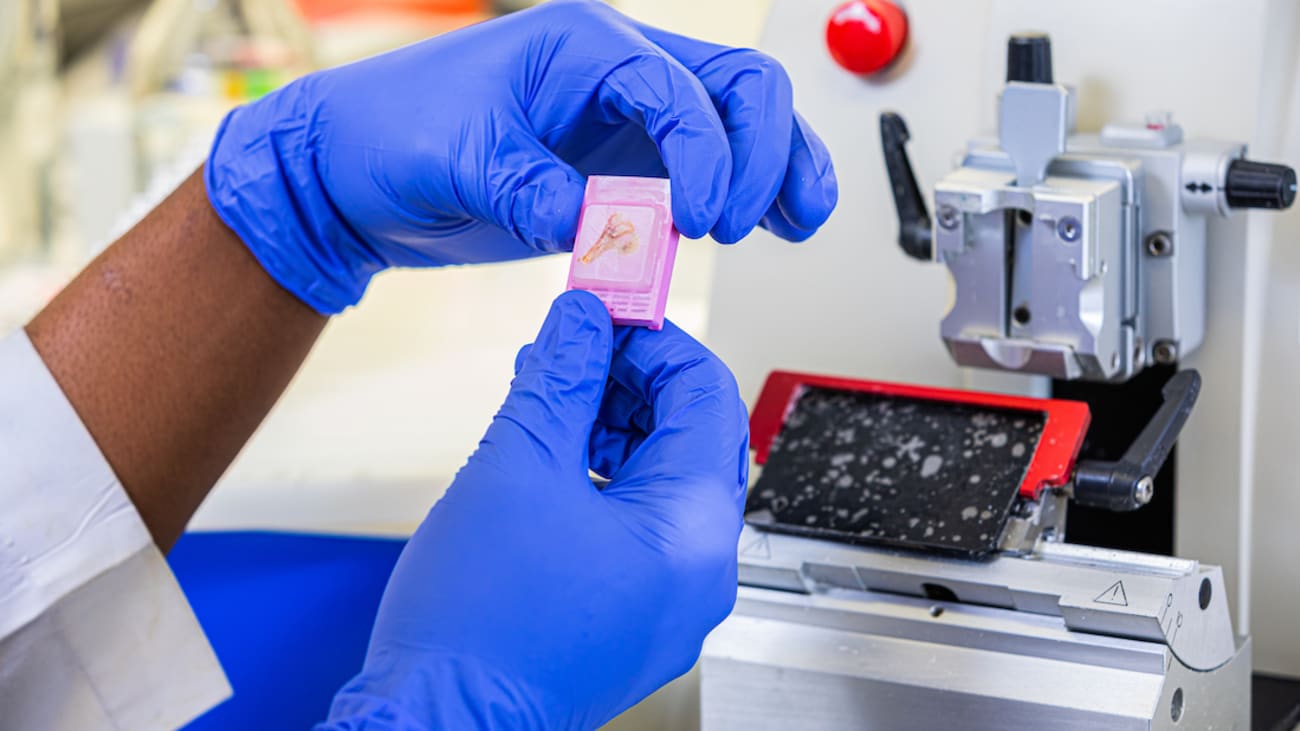 Simmons Cancer Center awarded nearly $19 million in CPRIT funding - UT ...
