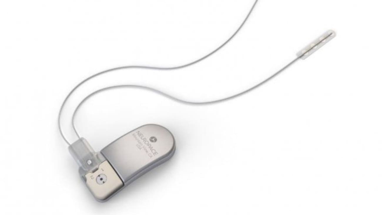 Seizure Risk Forecasted Days in Advance with Brain Implant Data - UCSF ...