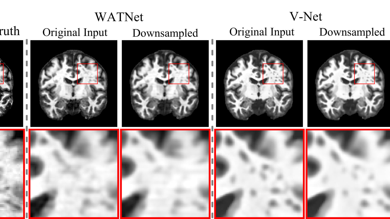 Enhancing MRI with AI to Improve Diagnosis of Brain Disorders - UCSF ...