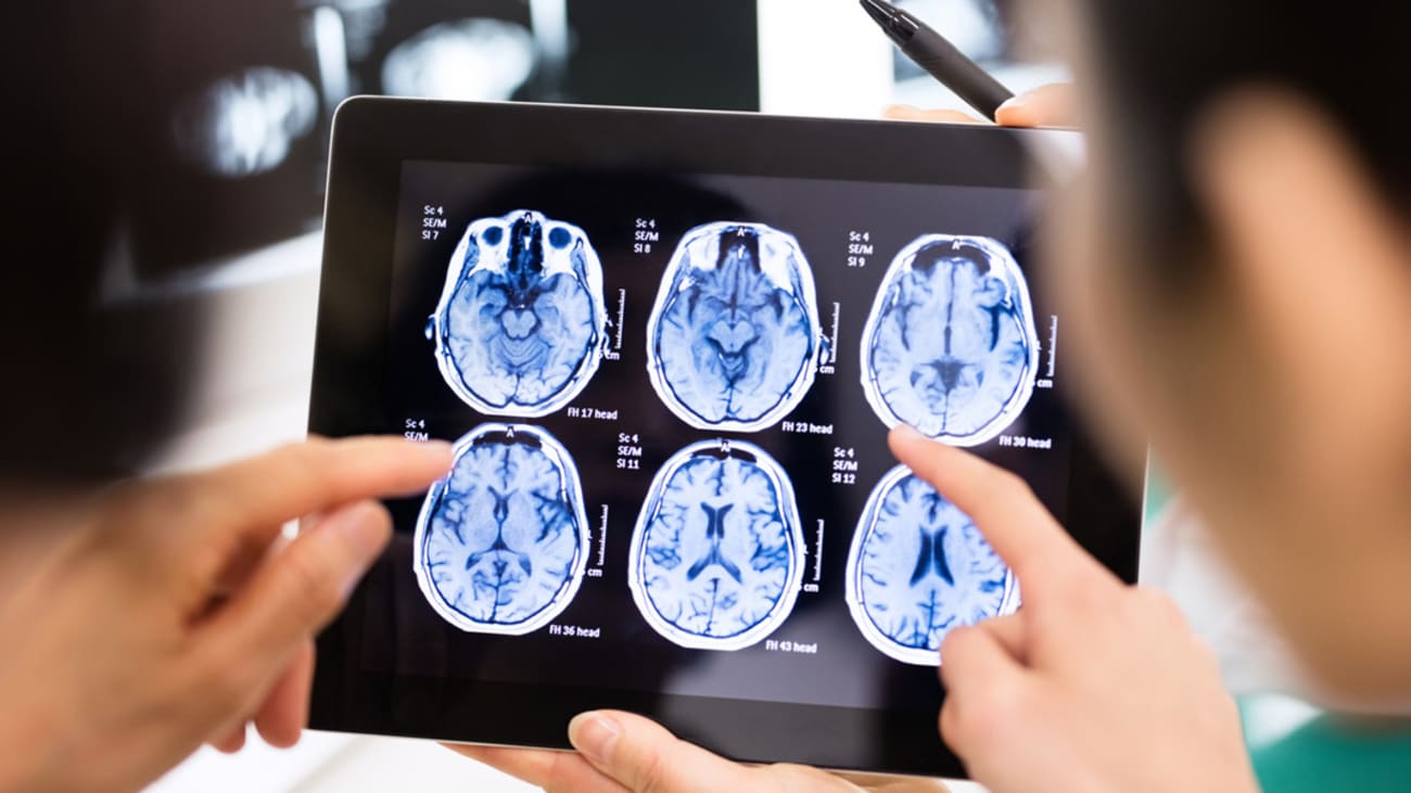 Optimizing Care Following Traumatic Brain Injury: Rapid Laboratory Test ...