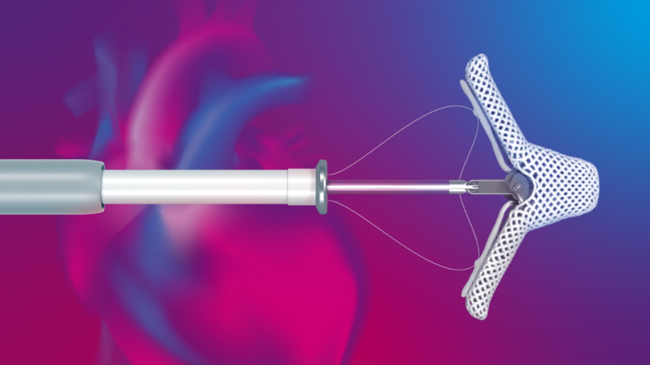 Penn Study Finds Reassuring Data on Common Heart Valve Procedure ...