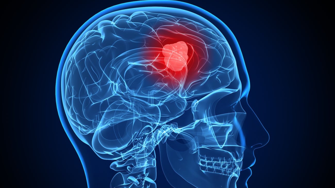 John de Groot, MD, Named Division Chief of Neuro-Oncology at UCSF ...